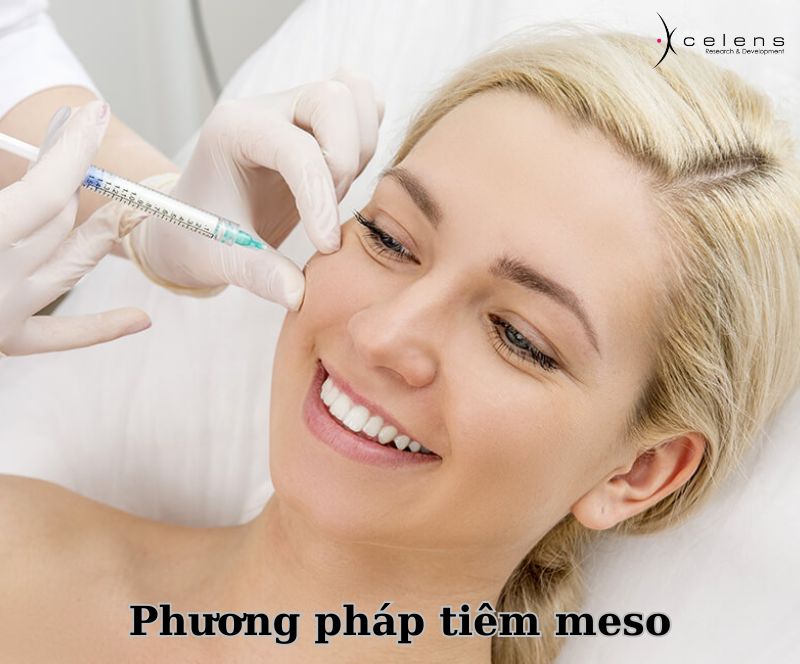Khám Phá 5 Tác Dụng Của Tiêm Meso Cho Làn Da Sáng Mịn - Cung cấp meso-b ...